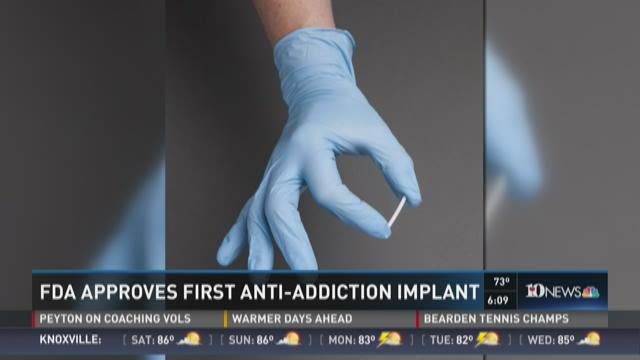 FDA approves anti-addiction implant | wbir.com